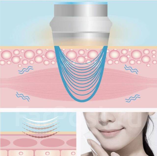 Аппарат для фонофореза, новый, под заказ. Цена: 7 000₽ во Владивостоке