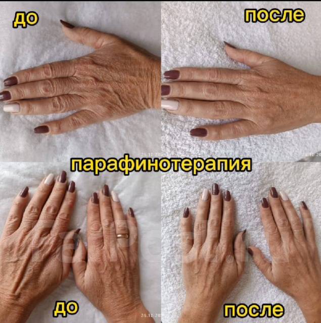 Профессиональный массаж лица и тела в Находке